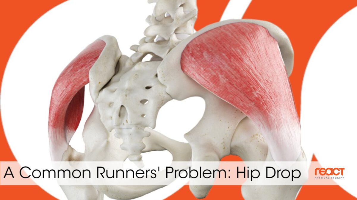 A Common Runners' Problem: Hip Drop - React Physical Therapy